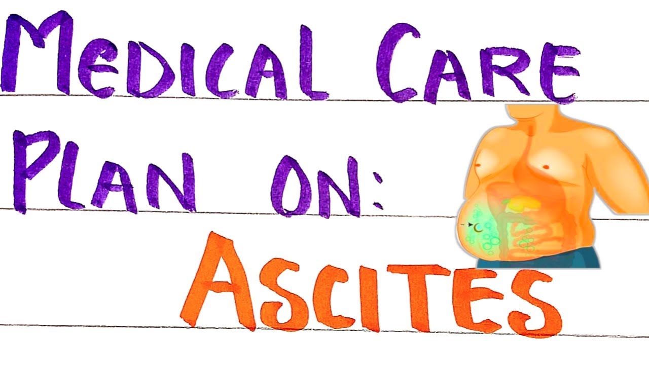 Nursing care plan on Ascites @NursingCriteria - YouTube