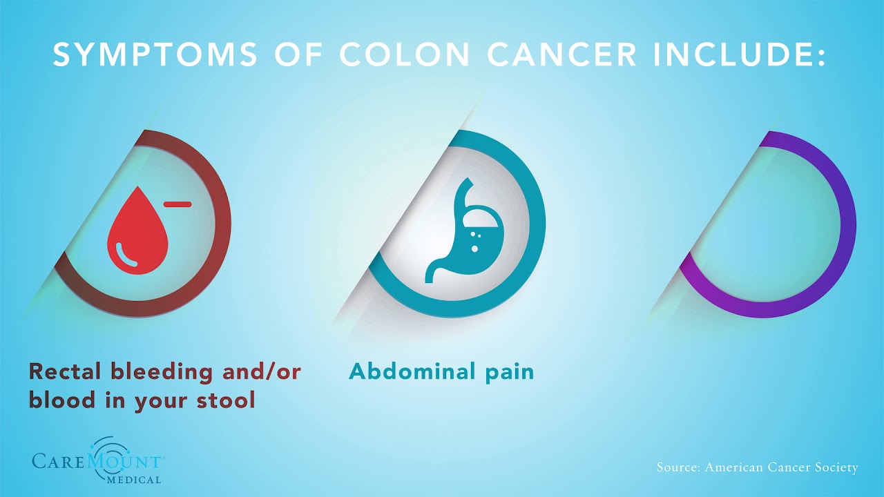 Signs and Symptoms of Colorectal Cancer - YouTube