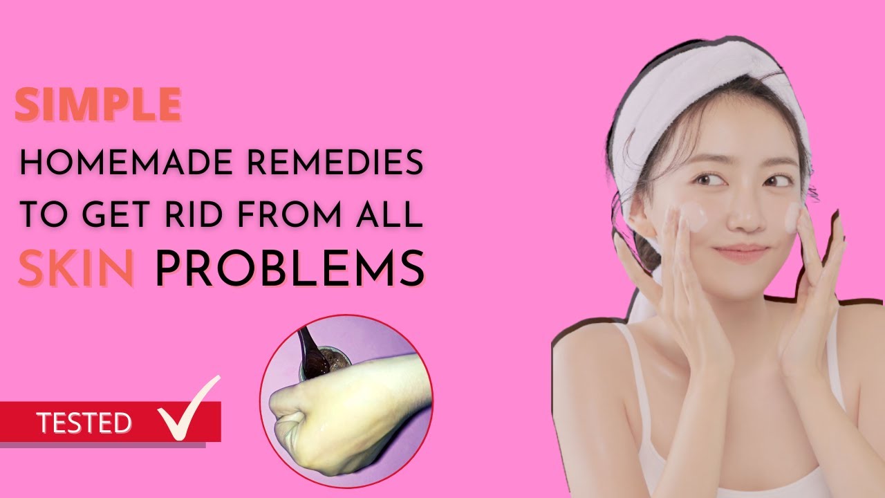 Get Rid From Any Skin Problem | Homemade Remedies For Many Skin ...