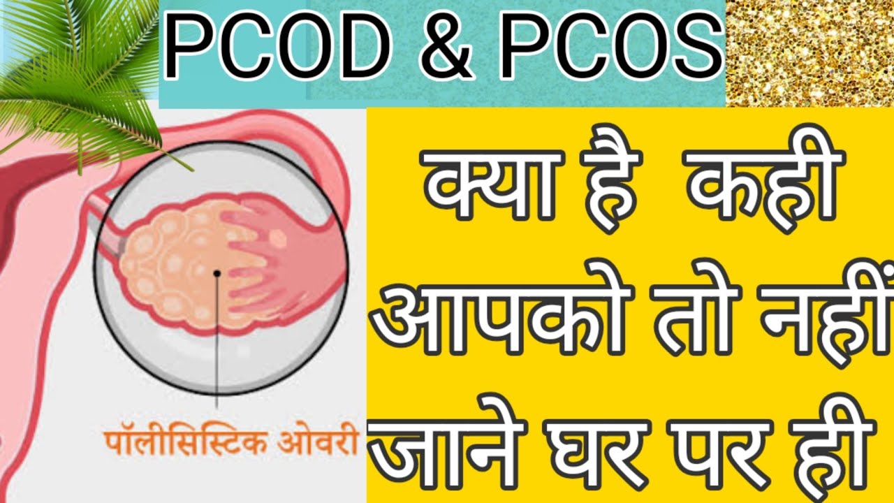 PCOD Problem Solution in Hindi |PCOD के लक्षण ओर घरेलू उपचार | We Are ...