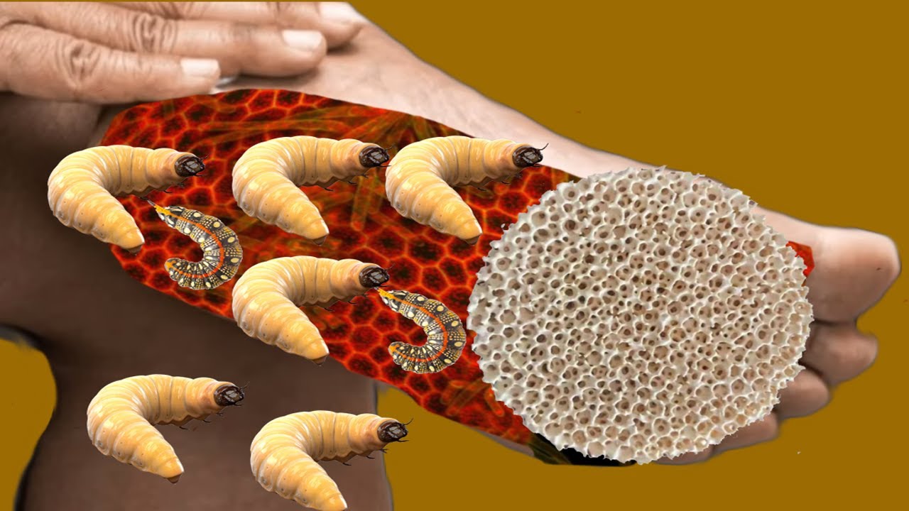 ASMR Treatment 2D Animation | ASMR Remove Dog Ticks and Trypophobia ...