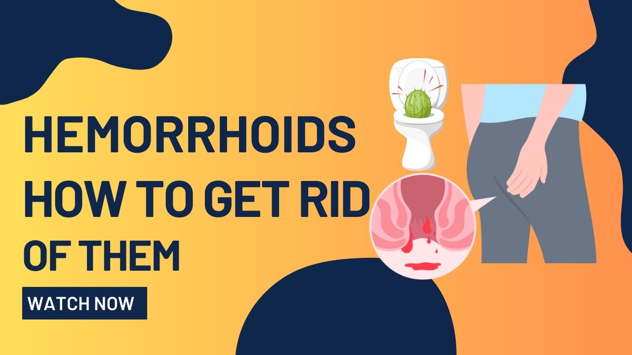 🔴How To Get RID Of HEMORRHOIDS. - YouTube