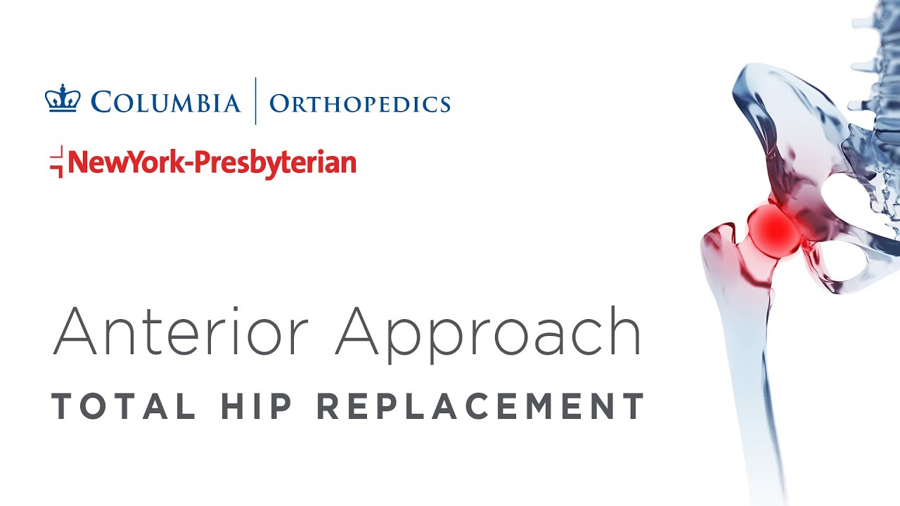 Total Hip Replacement: The Anterior Approach - YouTube