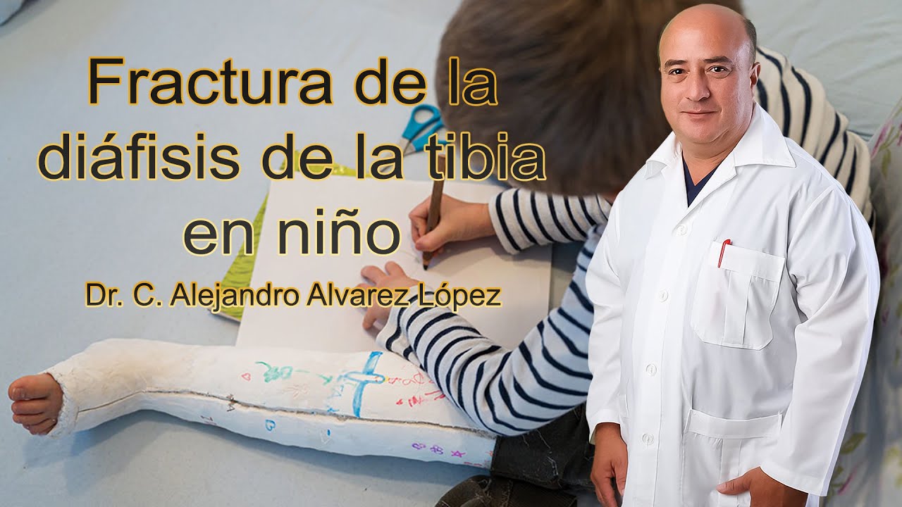 Fractura de la diáfisis tibial en el niño - YouTube