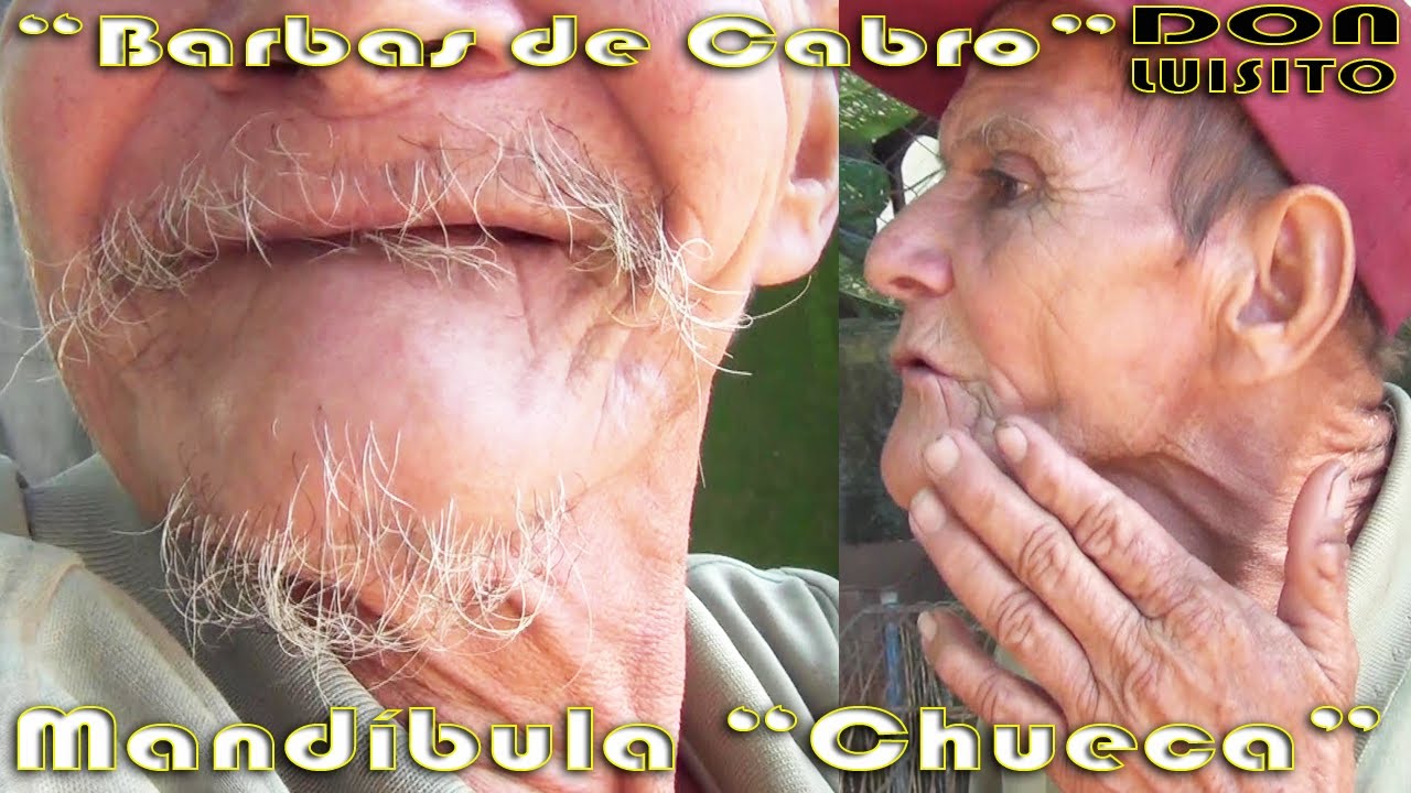 BARBAS DE CABRO y la historia de la mandíbula Chueca CAMINO A LA ...