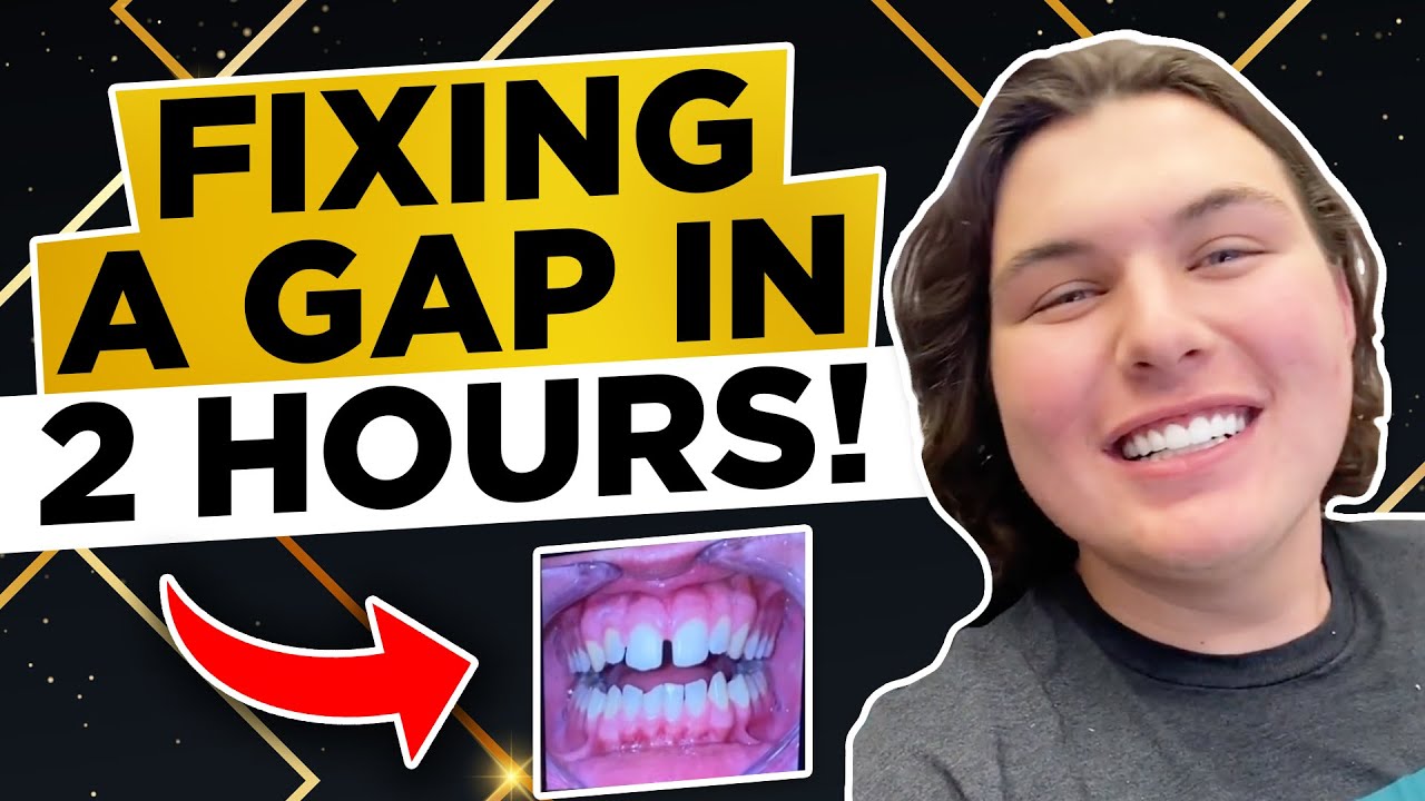 Fixing a Gap in 2 Hours! - YouTube