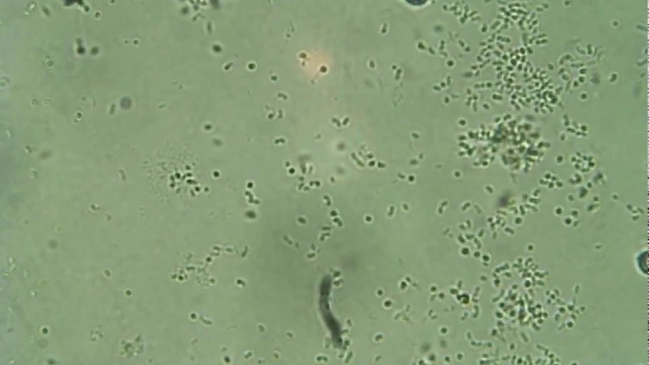 Prokaryotic Cells Under Microscope