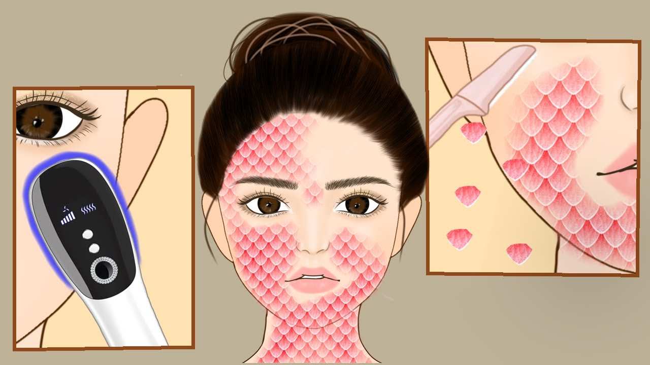 asmr animation: oddly satisfy skin problem - YouTube