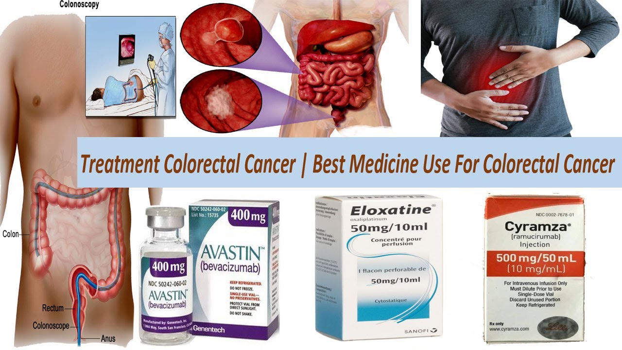 Treatment Colorectal Cancer | Best Medicine Use For Colorectal Cancer ...