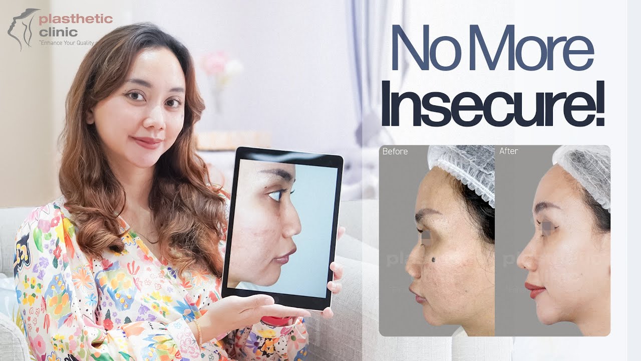 Honest Review‼️ Operasi Hidung & Operasi Tahi Lalat - YouTube