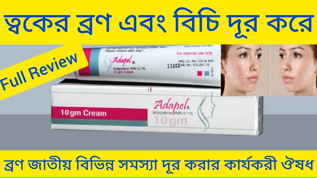 Adapel Cream Bangla/ দ্রুত ব্রণ দূর করার ঔষধ/ Adapel Cream এর কাজ কি ...