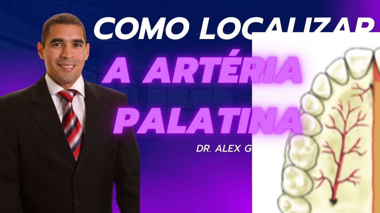 Como localizar a artéria palatina @dr.alexguedes - YouTube