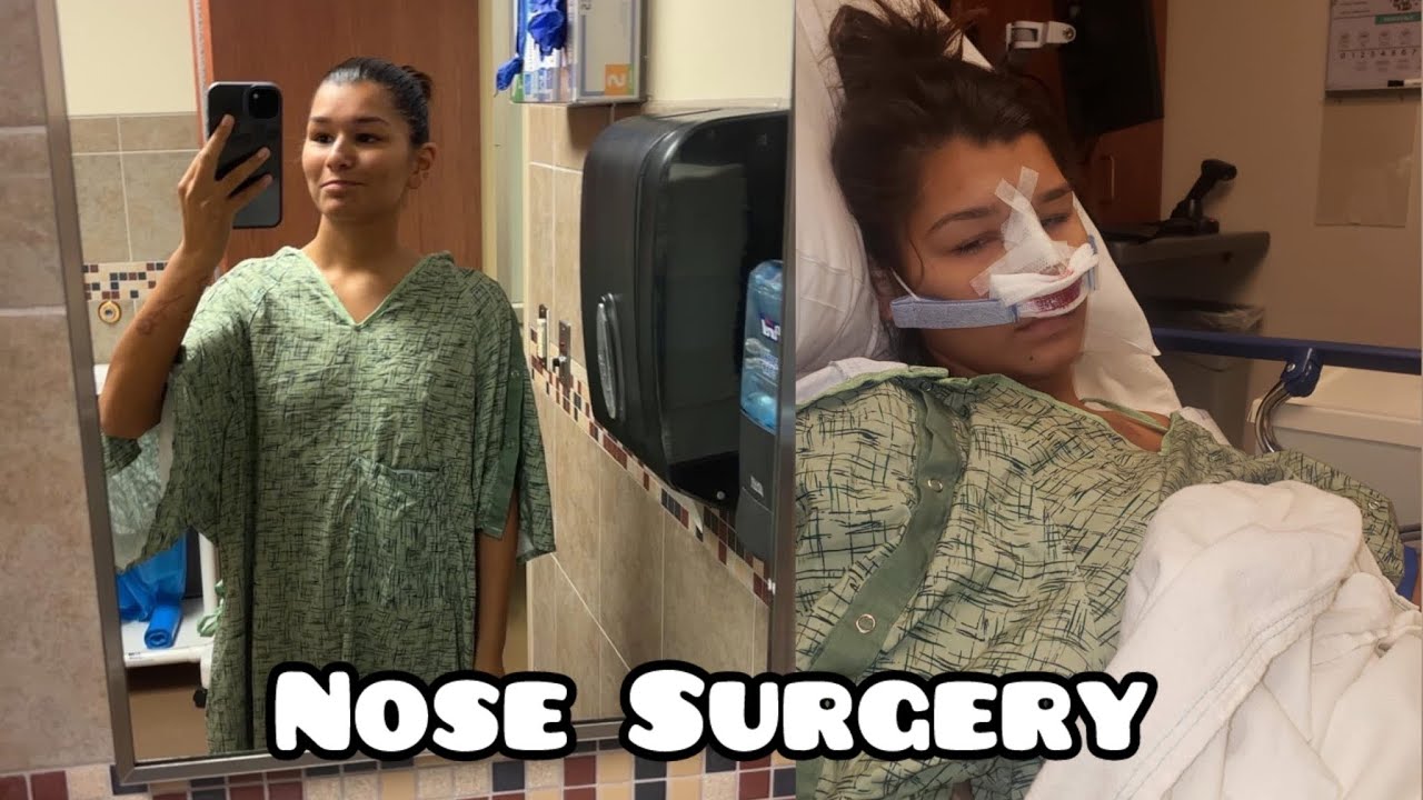 Getting Nose Surgery | Sully's Rhino-Septoplasty Video Takeover - Part ...