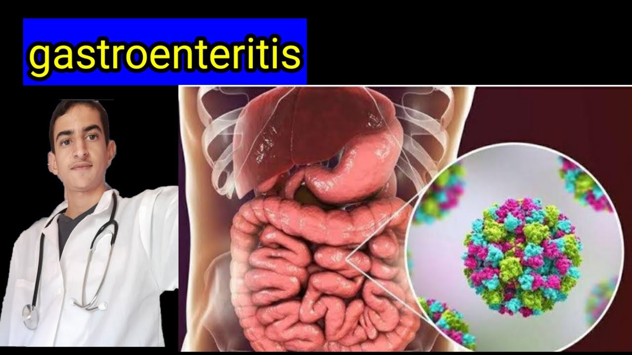 gastroenteritis - YouTube
