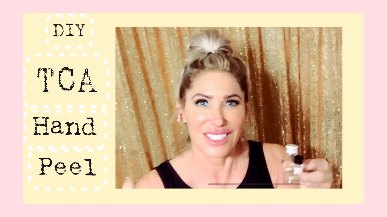 DIY TCA Hand Peel - YouTube
