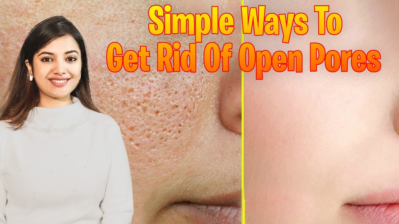 Minimize Pores Naturally: Dermatologist's Top Secrets Revealed! - YouTube