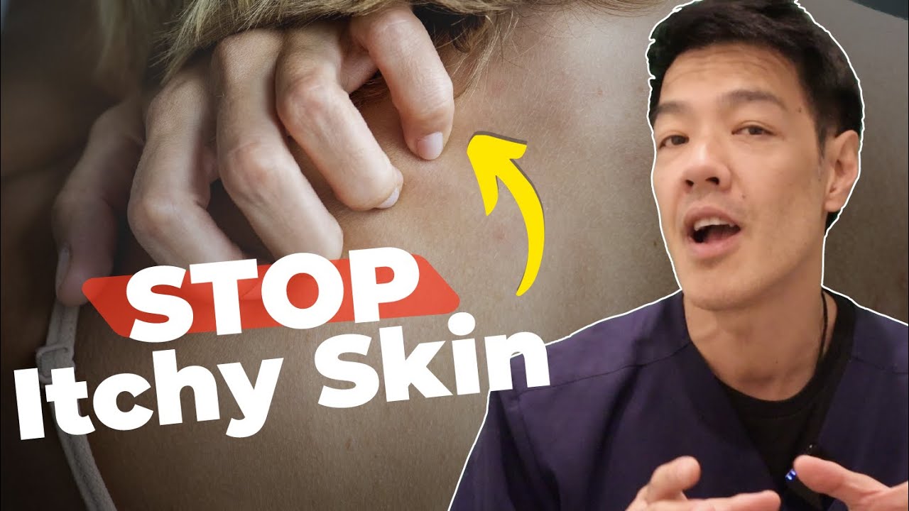 Stop the Itch – with Anti Itch Soothing Cream | Dr Davin Lim - YouTube