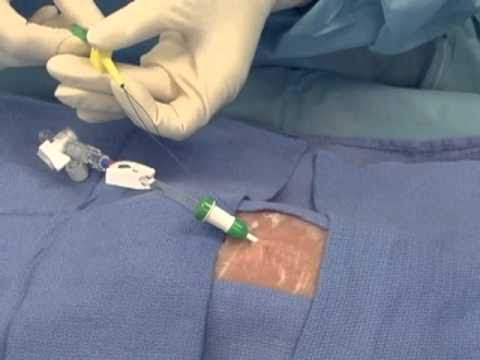 Slip-Not® Suture Retention Device Video - YouTube