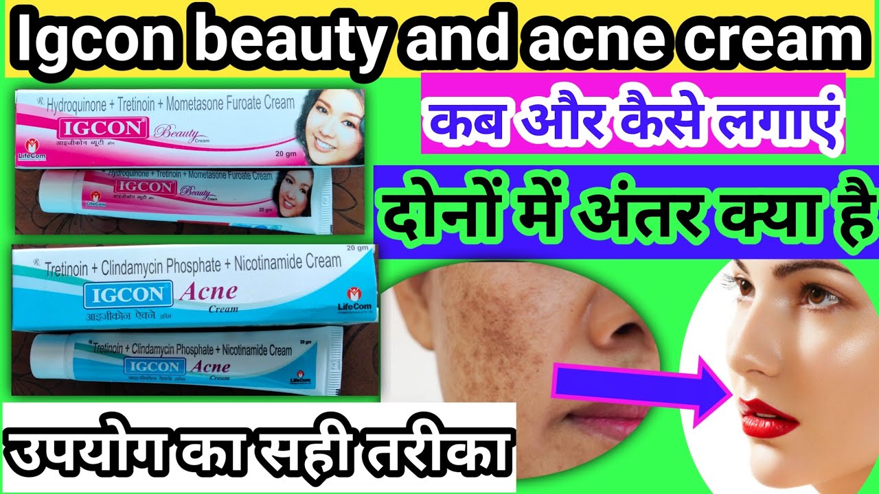 इग्कॉन ब्यूटी क्रीम का उपयोग हिंदी में | इग्कॉन एक्ने क्रीम का उपयोग ...