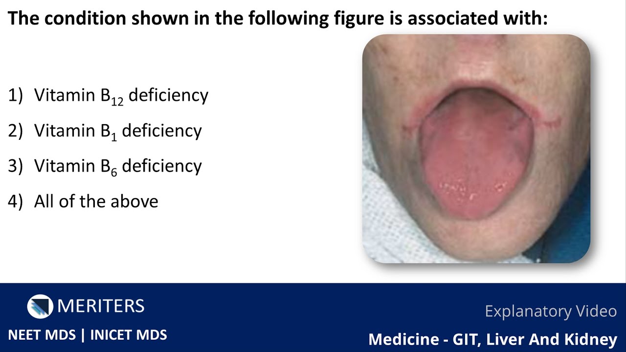 NEET MDS | INICET - Medicine - GIT, Liver And Kidney | Explanatory ...
