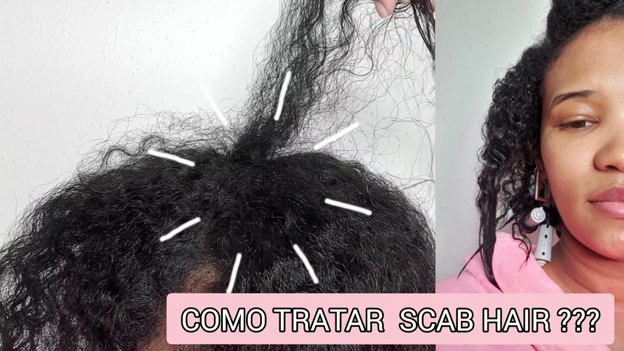 que-es-scab-hair-como-tratarlo-mi-cabello-no-se-define-que-hago