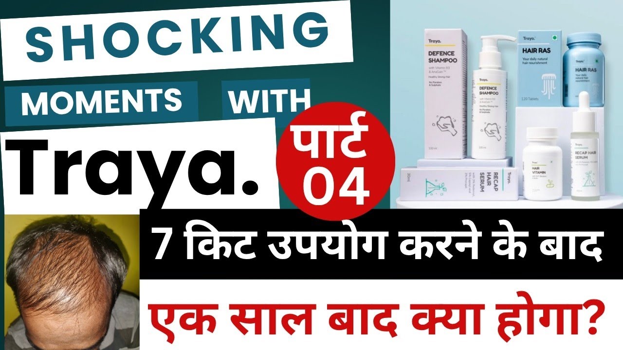 Traya hair kit review after 7 kits used | Traya hair loss solution ...