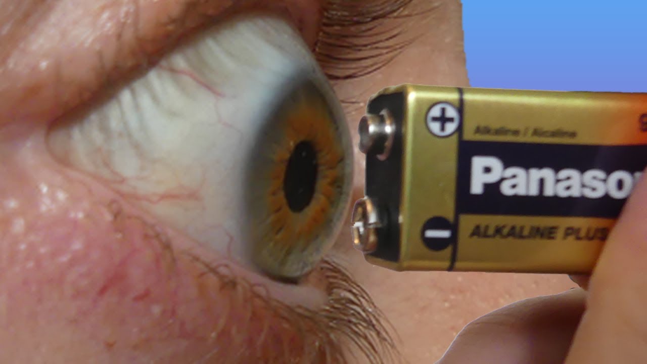 9V BATTERY IN MY EYE - YouTube