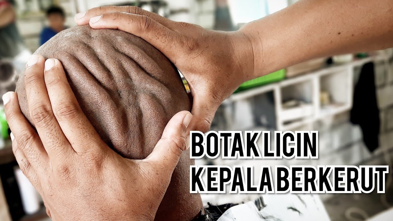 BOTAK LICIN MAXIMAL - YouTube