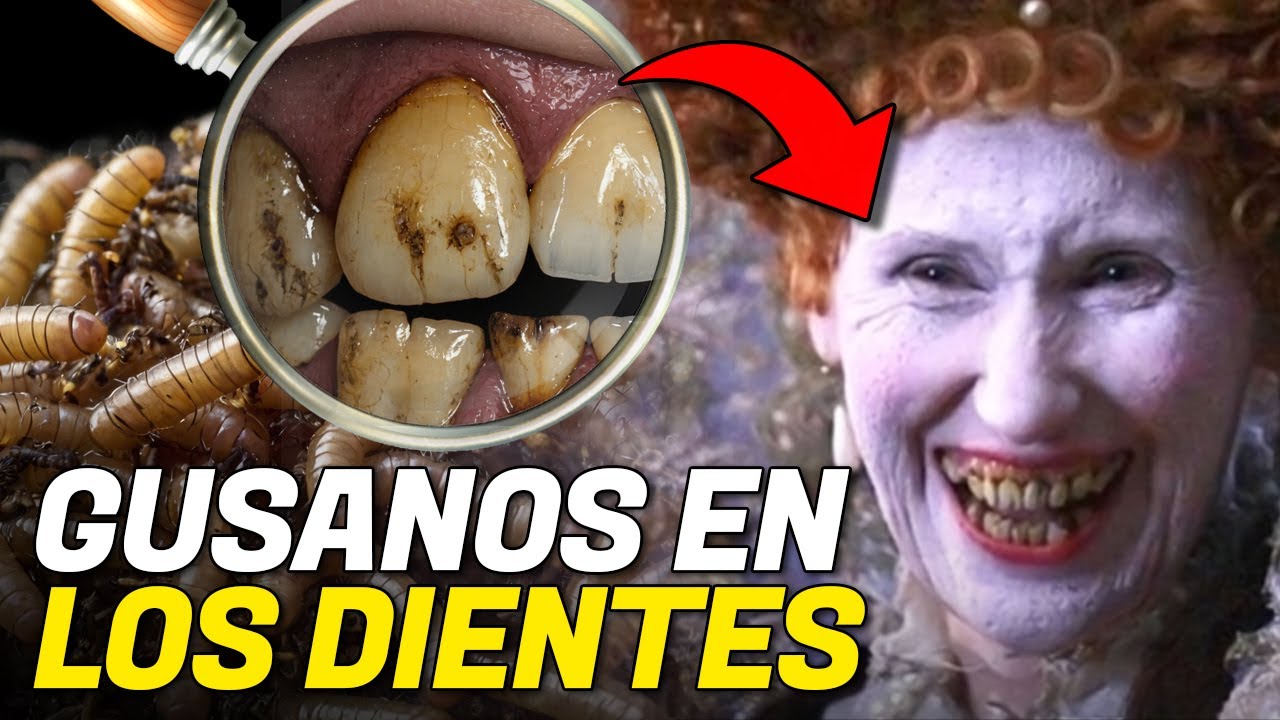 POR QUÉ LOS DIENTES PODRIDOS ERAN TAN EXITOSOS EN EL PASADO - YouTube
