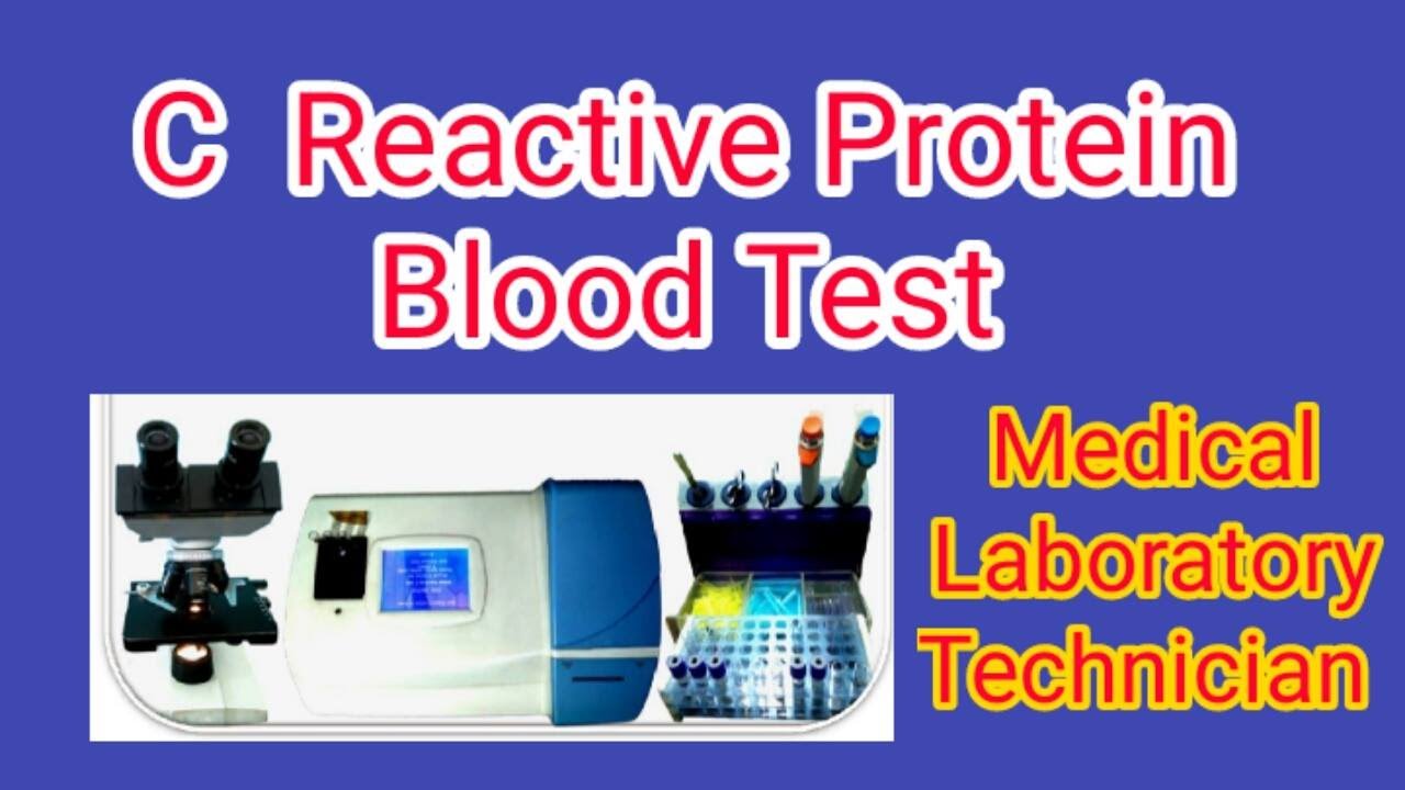 C Reactive Protein Test Procedure | CRP Test Range | C-reactive Protein ...