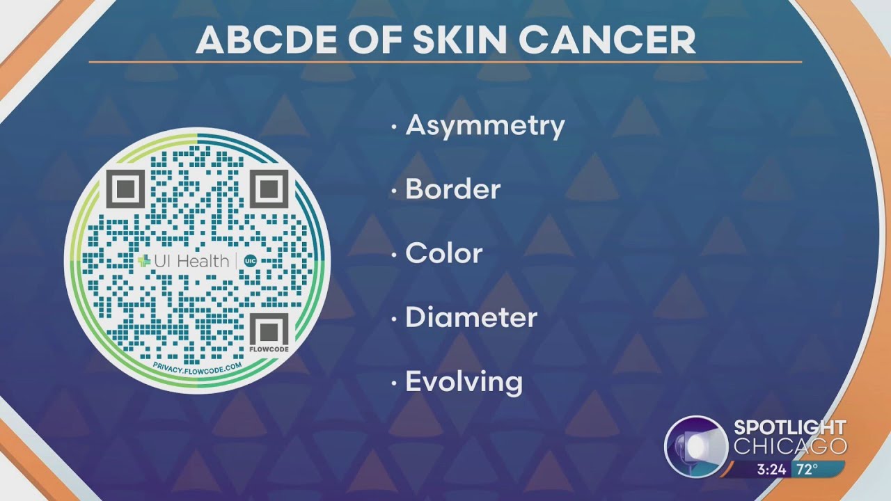 Identifying Signs Of Skin Cancer - YouTube