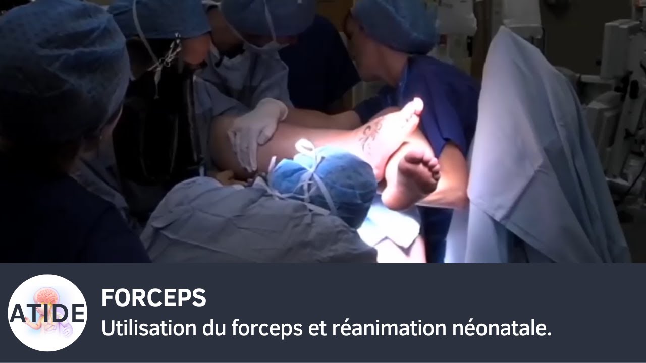 Utilisation du forceps et réanimation néonatale. - YouTube