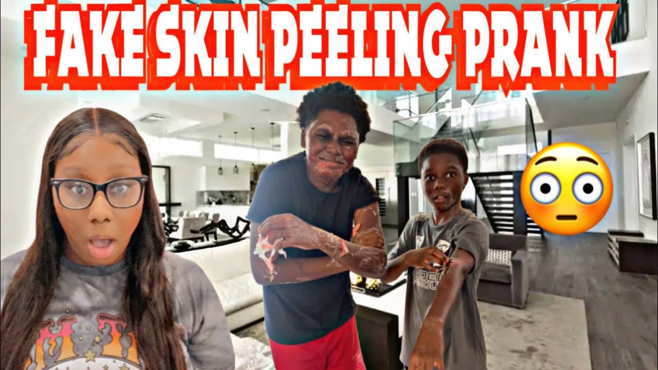 Fake Skin Peeling Prank on My MoM | *Hilarious* (Must Watch) - YouTube