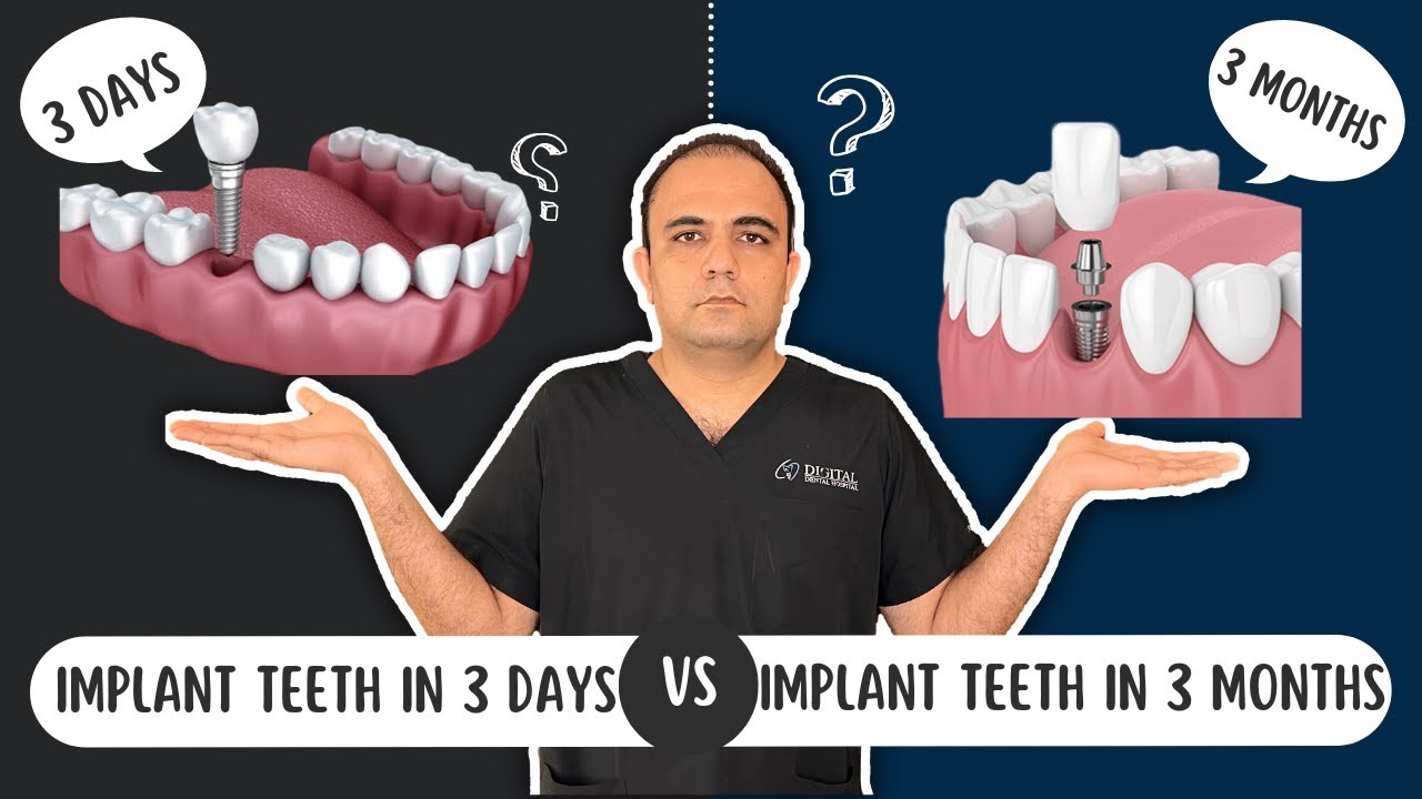 immediate implants vs delayed implants and their cost difference # ...