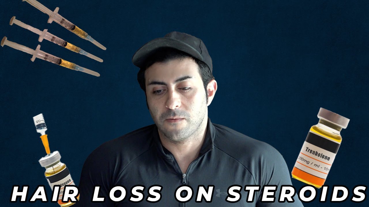 How to prevent Hair loss on steroids👺 ? Should you take Finasteride ...