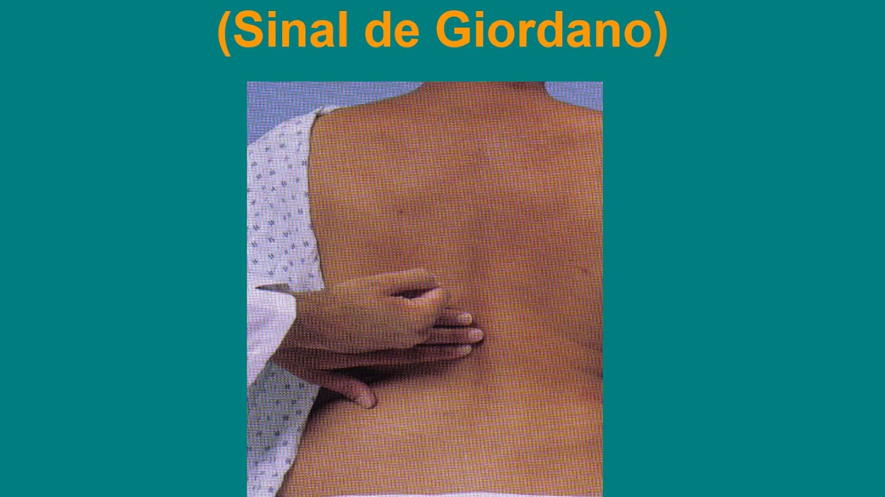 Cólica Renal - Urolitíase - YouTube