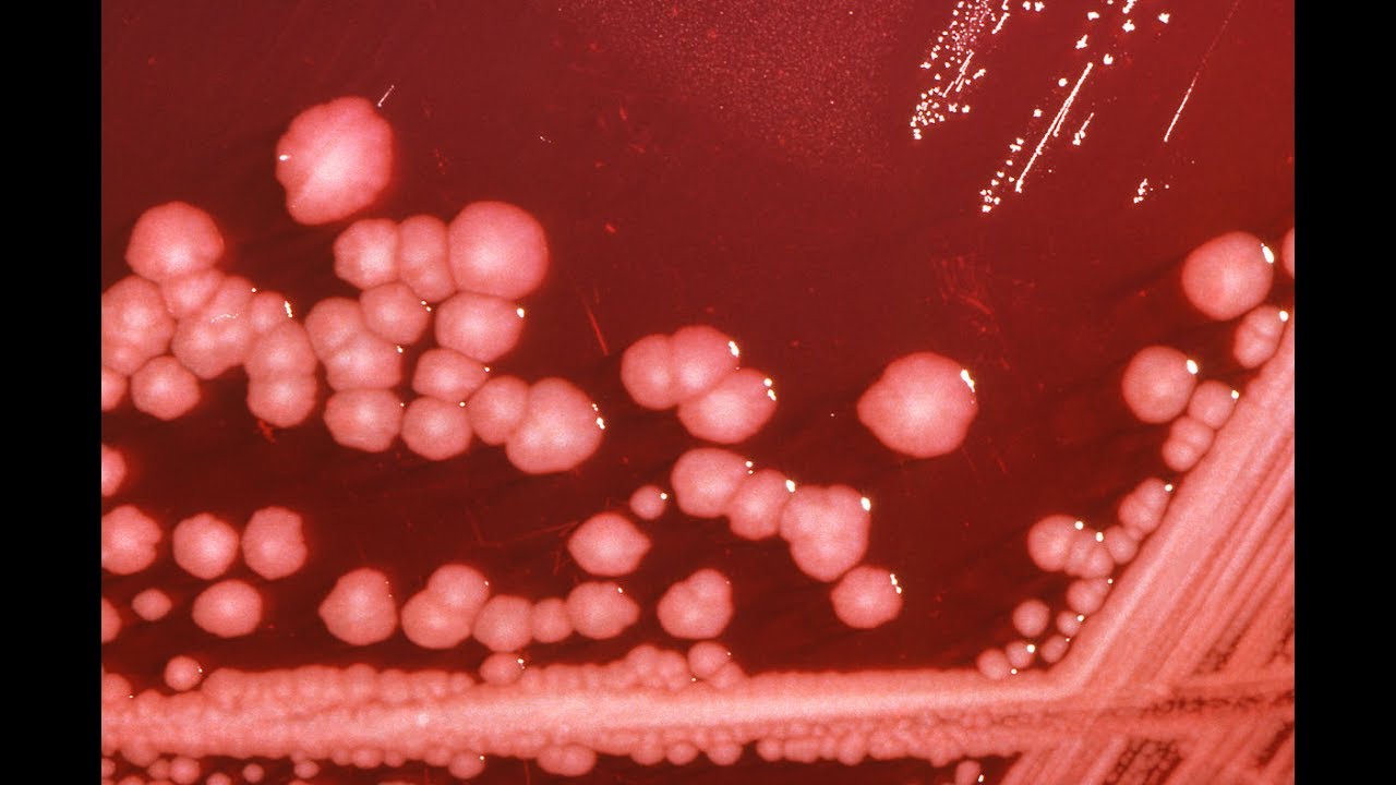 Proteus spp 1 - YouTube