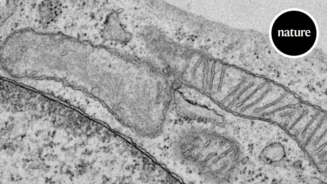 Mitochondria Structure Mitochondria In Disease: Changes In Shapes And