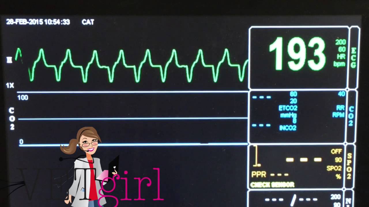 Hyperkalemia Ecg Cat