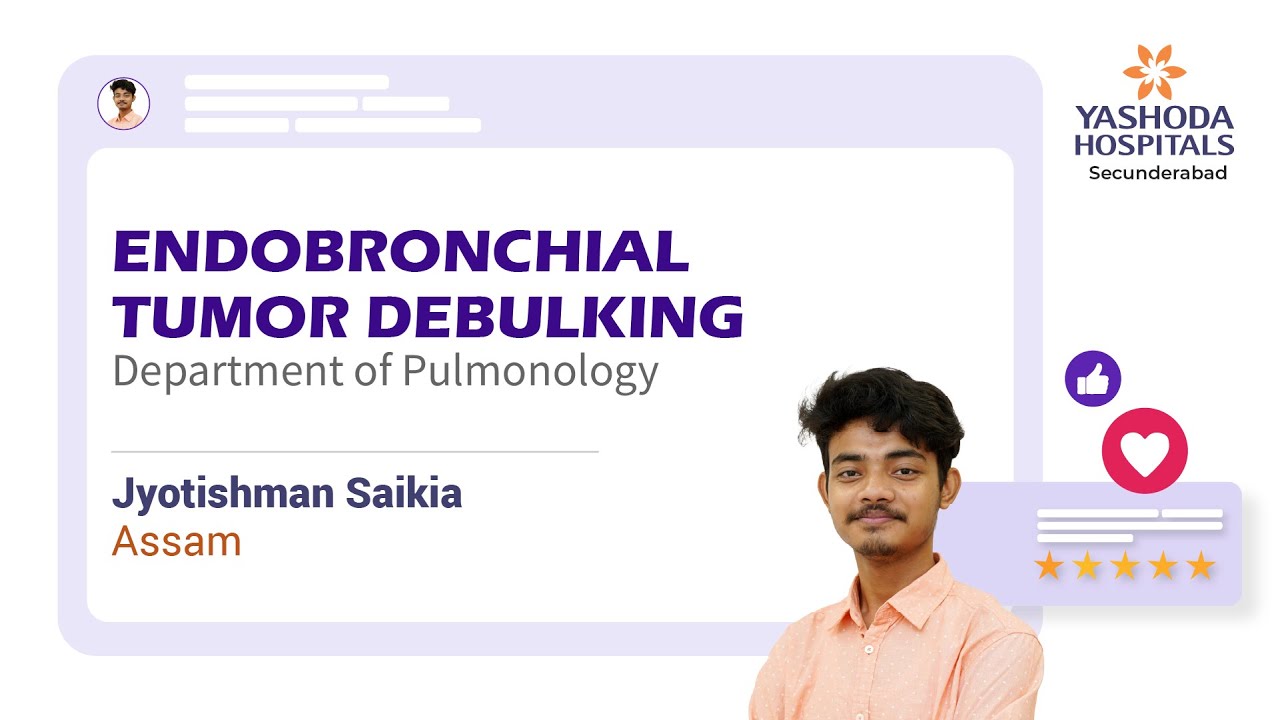 Endobronchial Tumor Debulking - YouTube