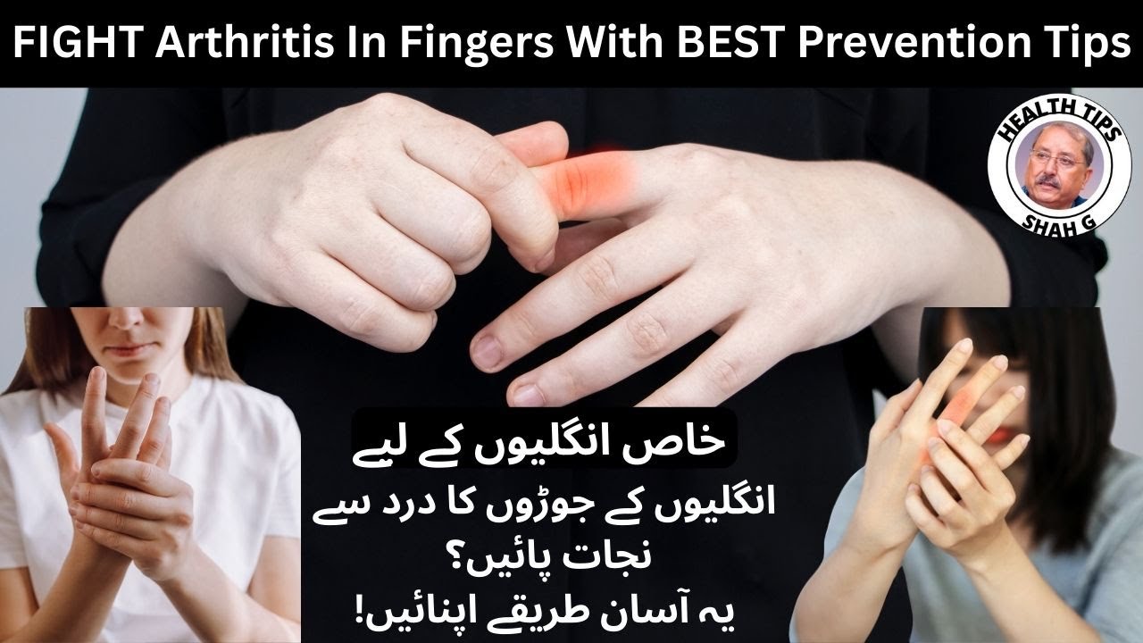 FIGHT Arthritis In Fingers With BEST Prevention Tips - YouTube
