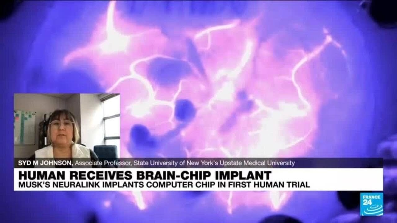 Neuroscience or Virtual Insanity? 'Musk's ultimate goal is a brain ...