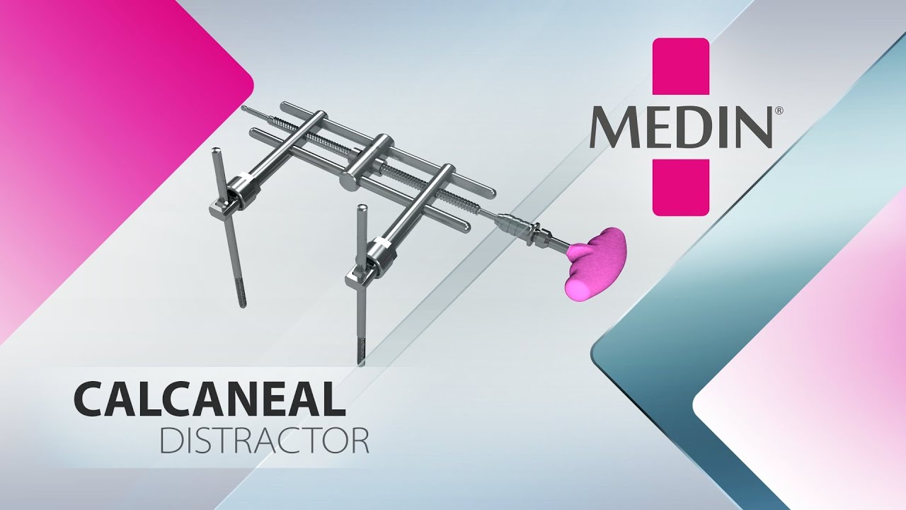Calcaneal distractor (EN) - YouTube
