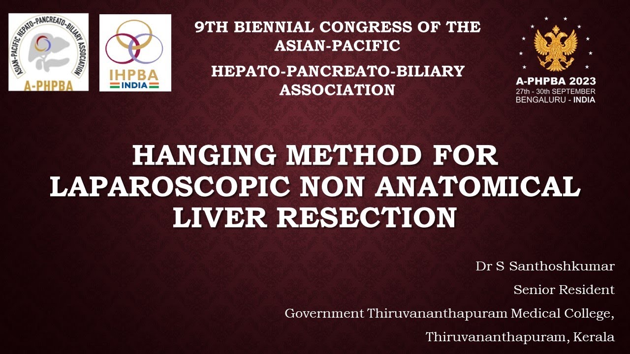 HANGING METHOD FOR NON ANATOMICAL LIVER RESECTION - YouTube