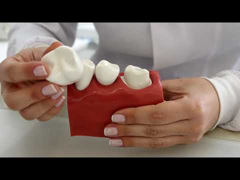 O que é Coroa Dental?