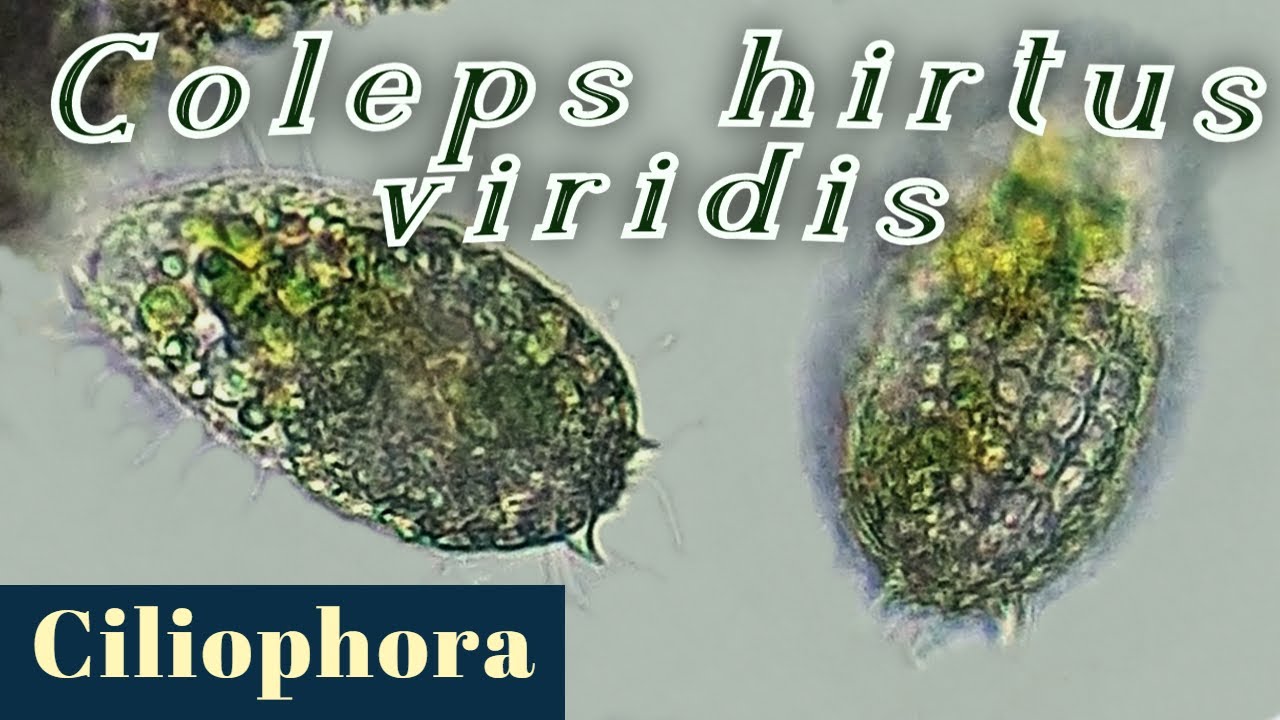 Coleps hirtus viridis (Ciliophora = Ciliate) - YouTube
