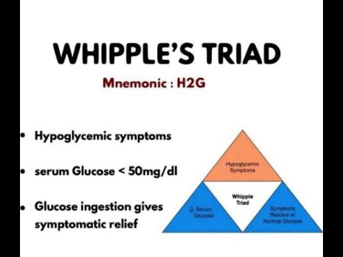 Whipple's Triad ; Definition, Components, Diagnostic criteria, Clinical ...