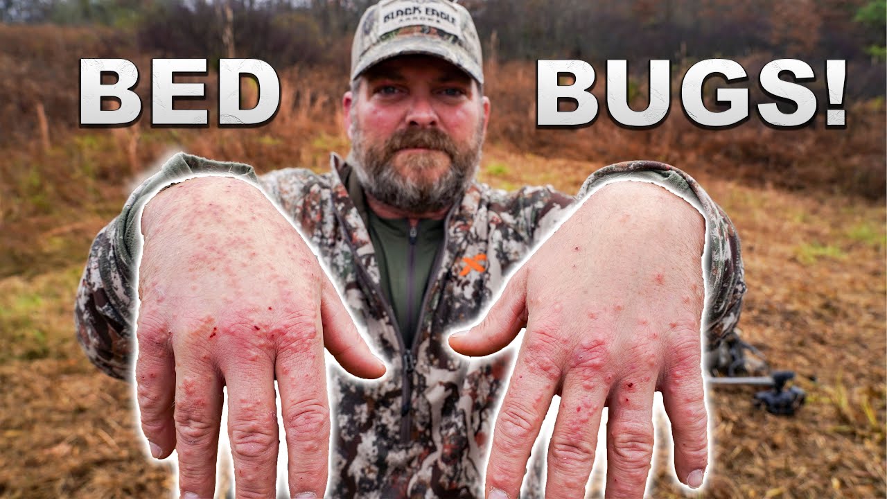 BED BUGS ON A HUNTING TRIP? Pre-Rut Hunt to Kentucky! - YouTube