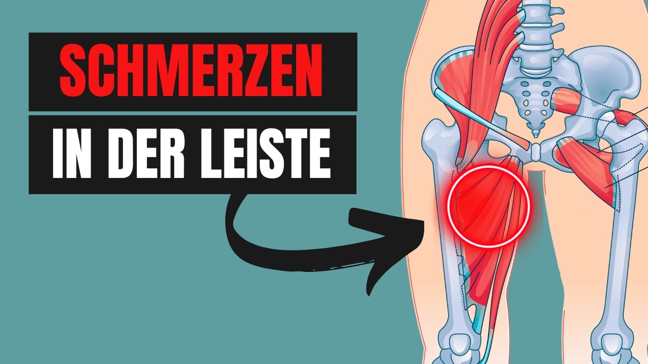 Schmerzen in der Leiste (Ursache, Diagnose, Übungen & Therapiepläne ...