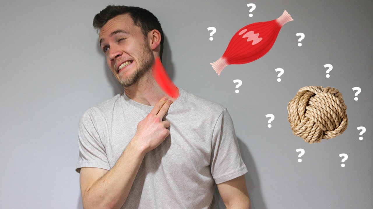Trigger points? Muscle Knots? Physiotherapist Explains. - YouTube